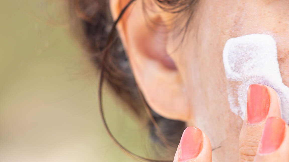 Sonnenallergie oder Sonnenbrand – woran kann man das erkennen? | Haut ...